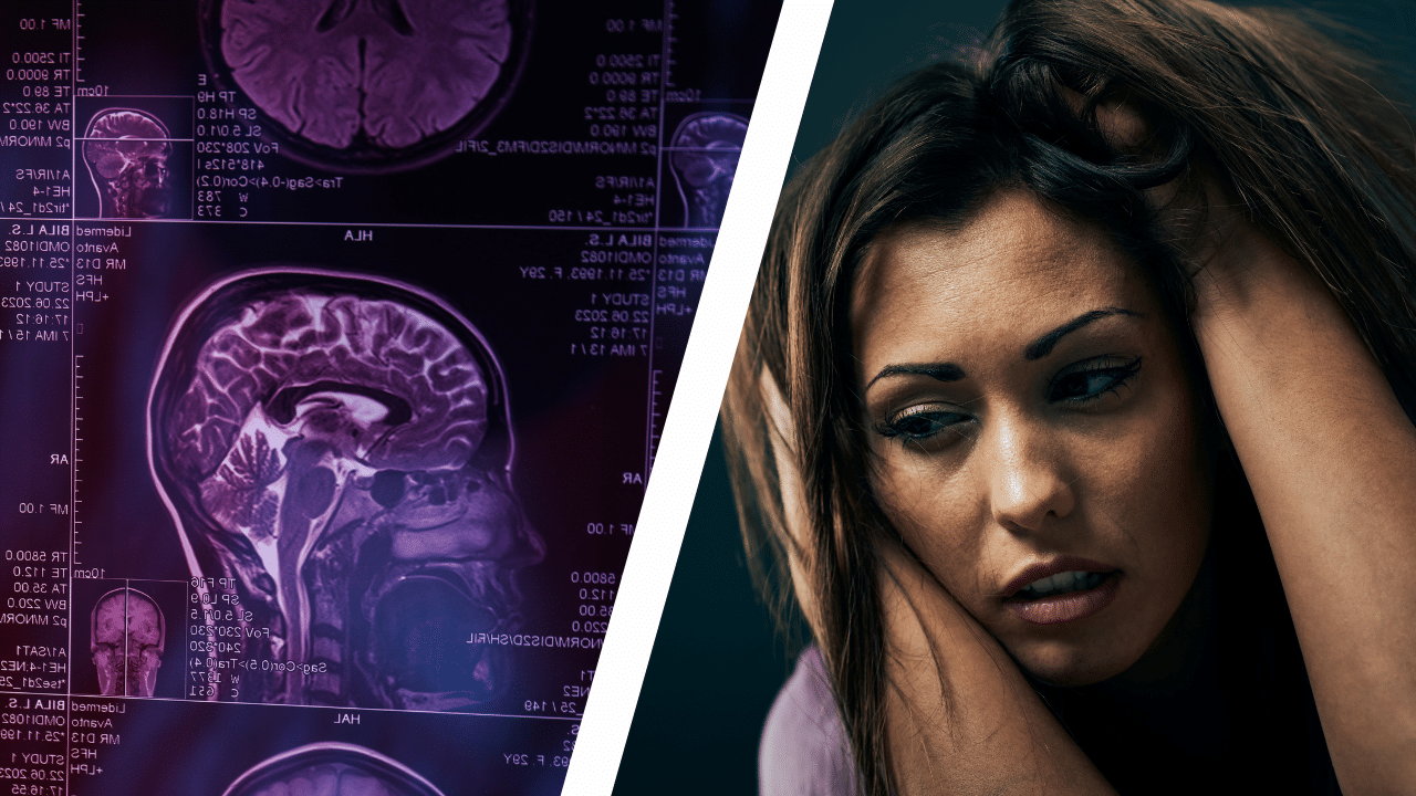 How to Stop OCD Thoughts Naturally: 7 Expert Strategies